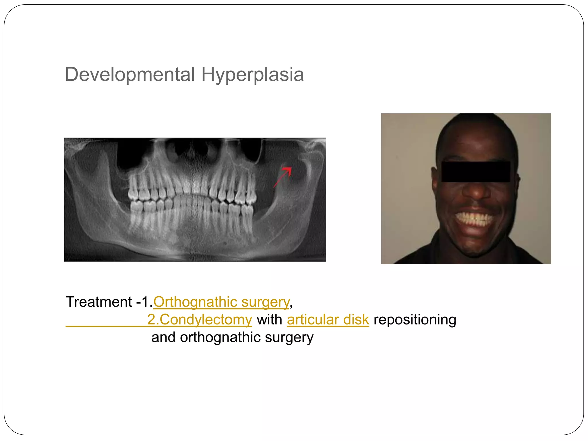 GROWTH AND DEVELOPMENT OF TEMPOROMANDIBULAR JOINT.pptx