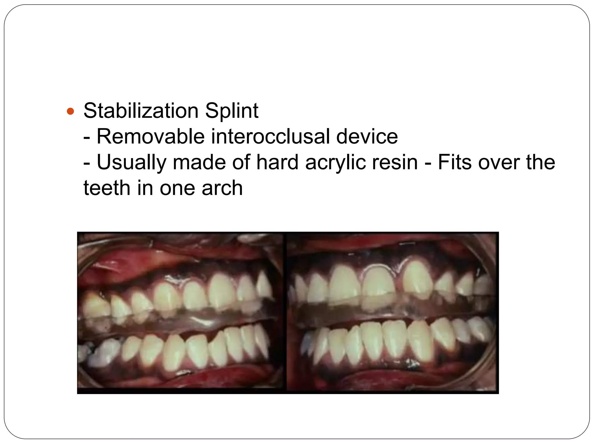 GROWTH AND DEVELOPMENT OF TEMPOROMANDIBULAR JOINT.pptx