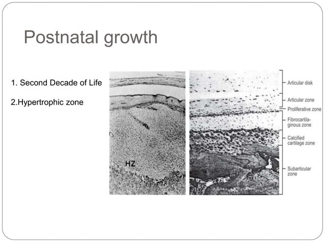 GROWTH AND DEVELOPMENT OF TEMPOROMANDIBULAR JOINT.pptx | Pregnancy ...
