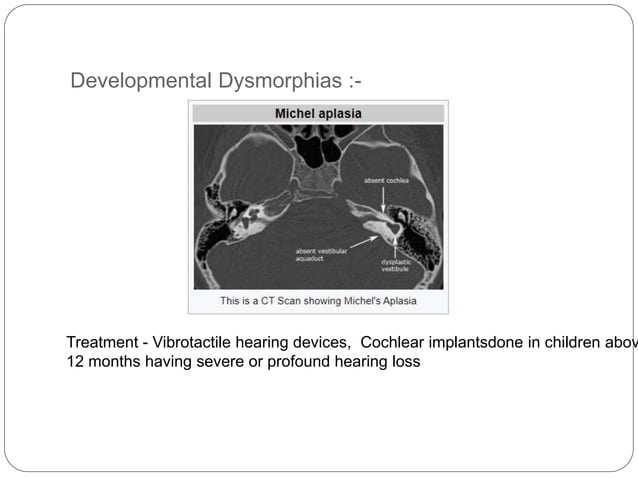 GROWTH AND DEVELOPMENT OF TEMPOROMANDIBULAR JOINT.pptx | Pregnancy ...