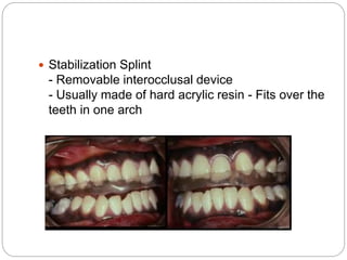 GROWTH AND DEVELOPMENT OF TEMPOROMANDIBULAR JOINT.pptx
