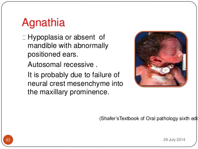 Growth and development of the mandible 1 seminar