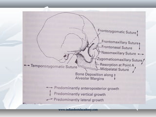 Nasomaxillary Suture