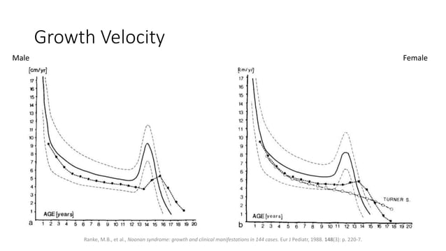 Growth and growth hormone therapy in children with noonan syndrome | PPTX Growth and growth hormone therapy in children with noonan syndrome | PPTX