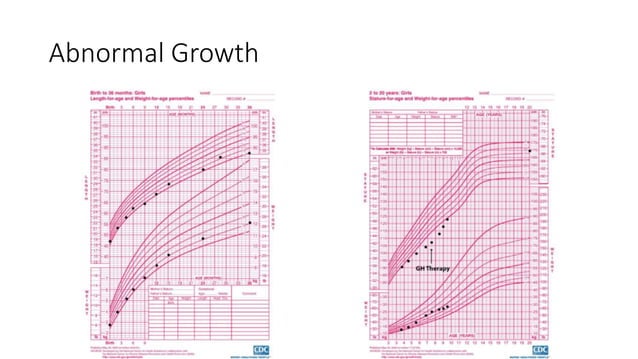 Growth and growth hormone therapy in children with noonan syndrome | PPTX