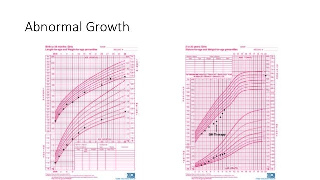 Growth and growth hormone therapy in children with noonan syndrome