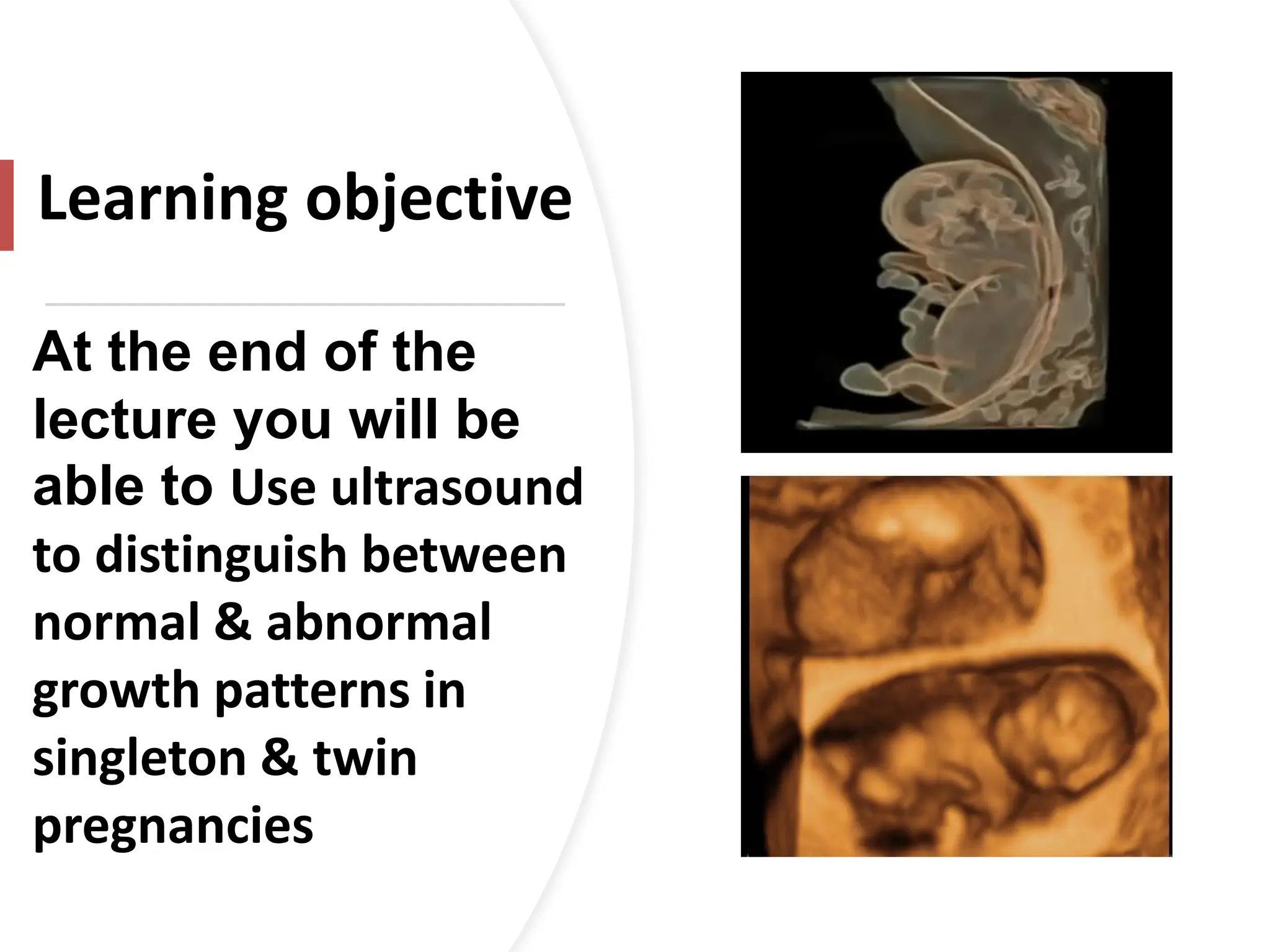 FETAL GROWTH ASSESSMENT CONCEPT OF F.G.R. & PLOTTING GROWTH CHARTS | PDF