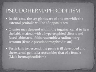 Growth anomalies of the female genital tract | PPTX