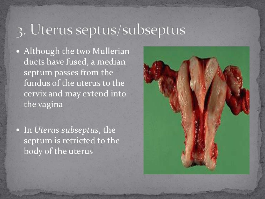 Growth anomalies of the female genital tract