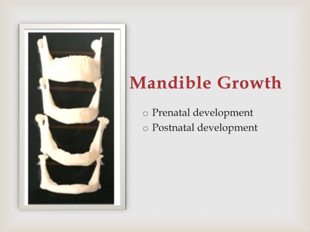 Growth changes of mandible | PPTX | Bone and Joint Conditions ...