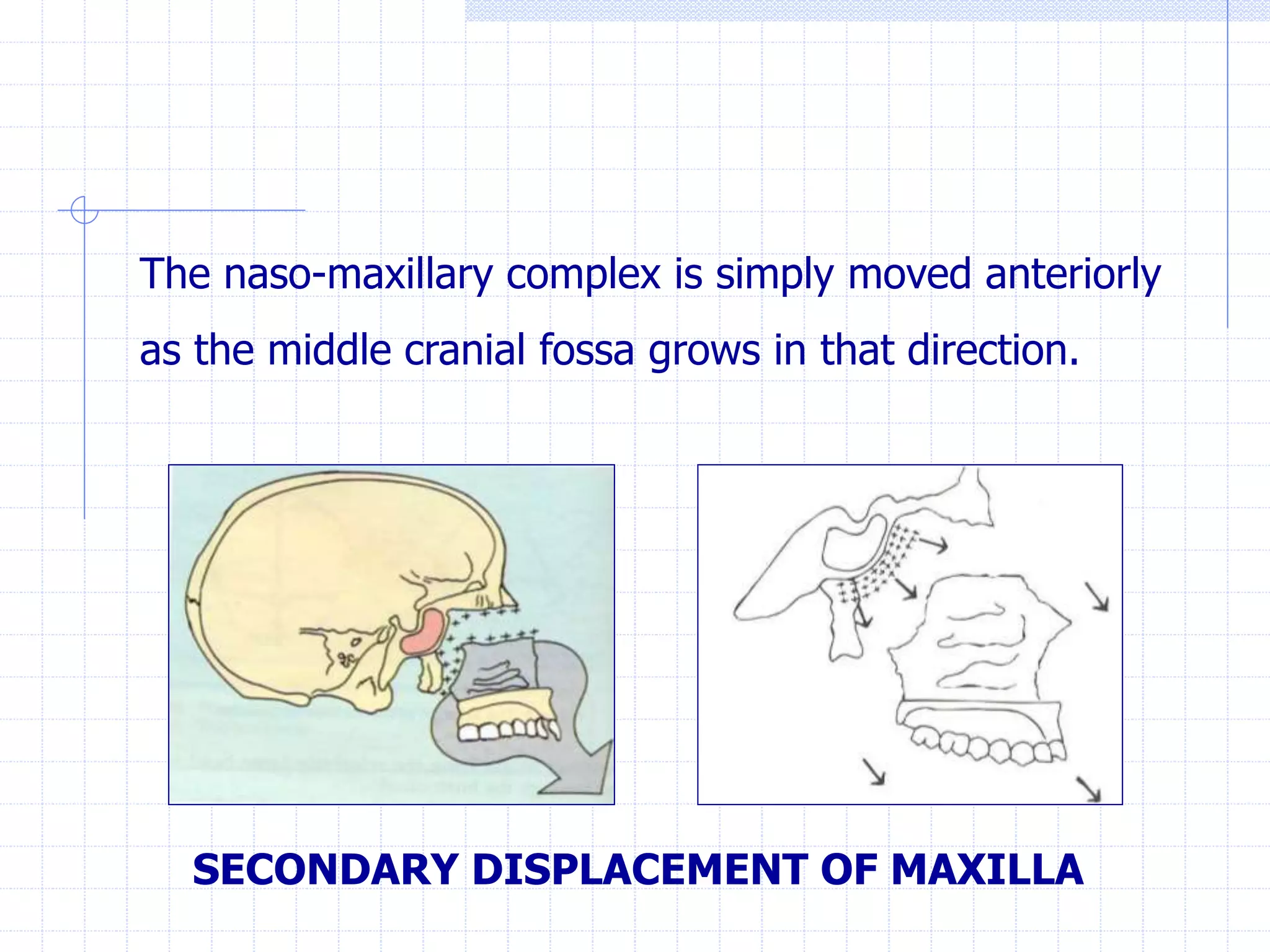 Growth & Development of Maxilla | PPT