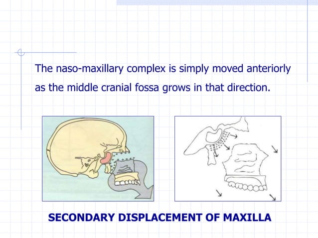 Growth & Development of Maxilla | PPT