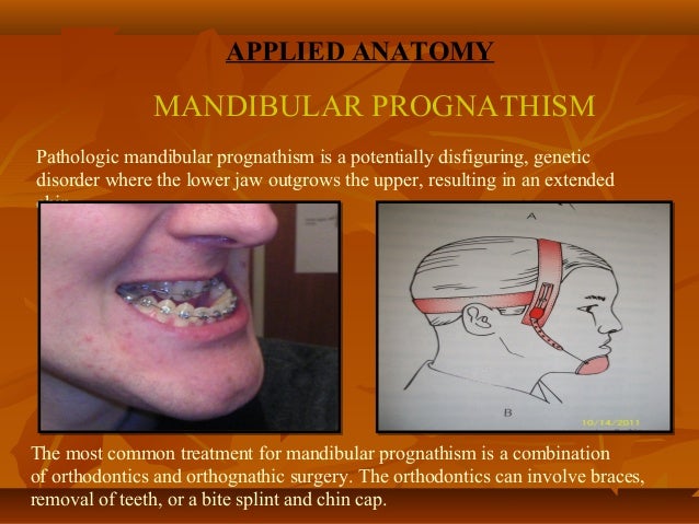 Growth & development of maxilla and mandible