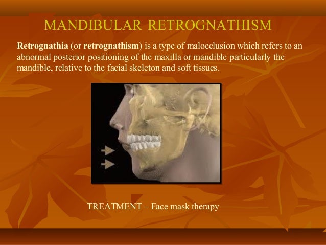 Growth & development of maxilla and mandible