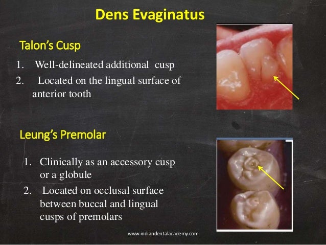 Growth&development of tooth / orthodontics courses