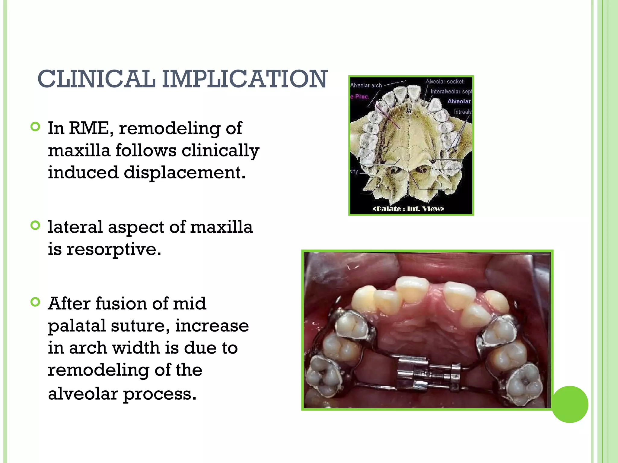 Growth & development of maxilla and mandible | PPT
