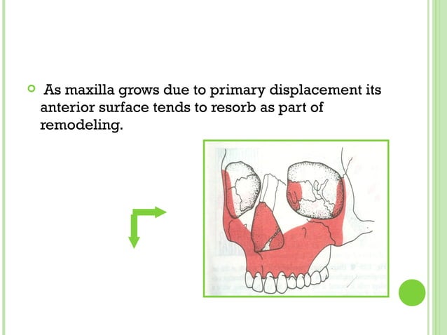 Growth & development of maxilla and mandible | PPT | Ear, Nose and ...