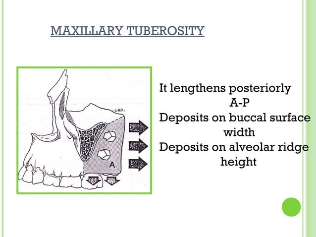 Growth & development of maxilla and mandible | PPT | Ear, Nose and ...