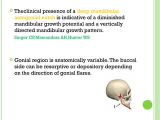 Growth & development of maxilla and mandible | PPT