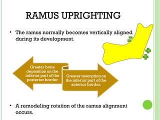 Growth & development of maxilla and mandible | PPT