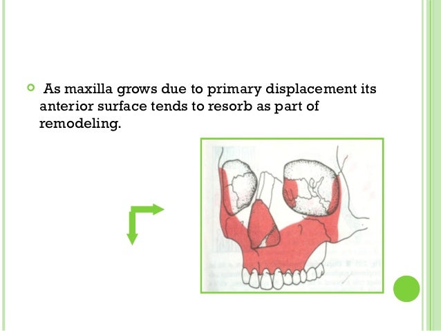 Growth & development of maxilla and mandible