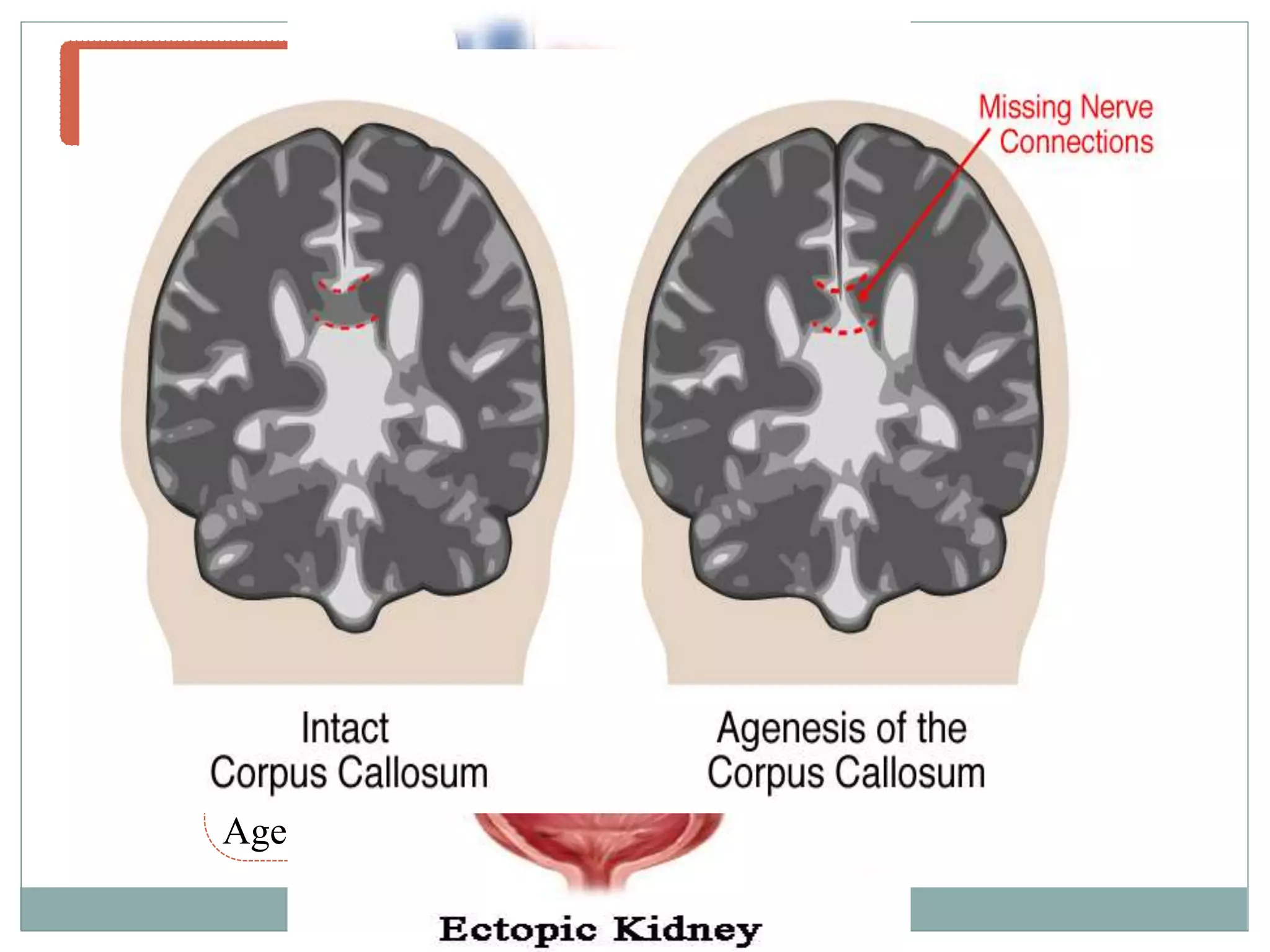 Growth disorder | PPTX