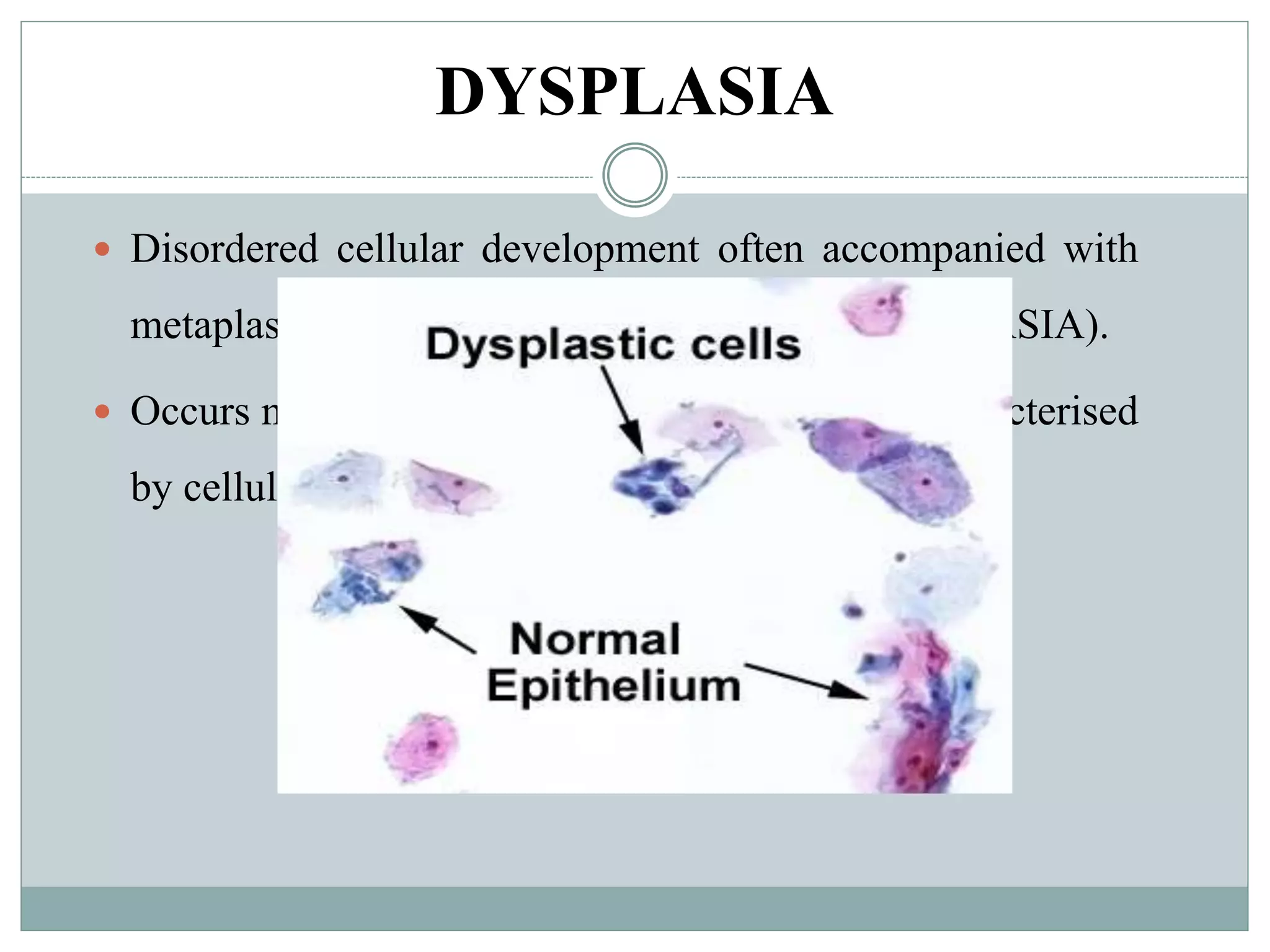 Growth disorder | PPTX