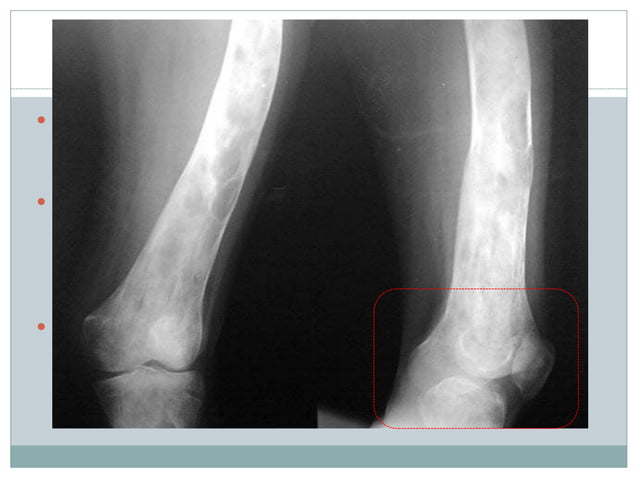 Growth disorder | PPTX