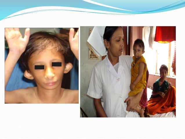 Growth Disorders | PPTX