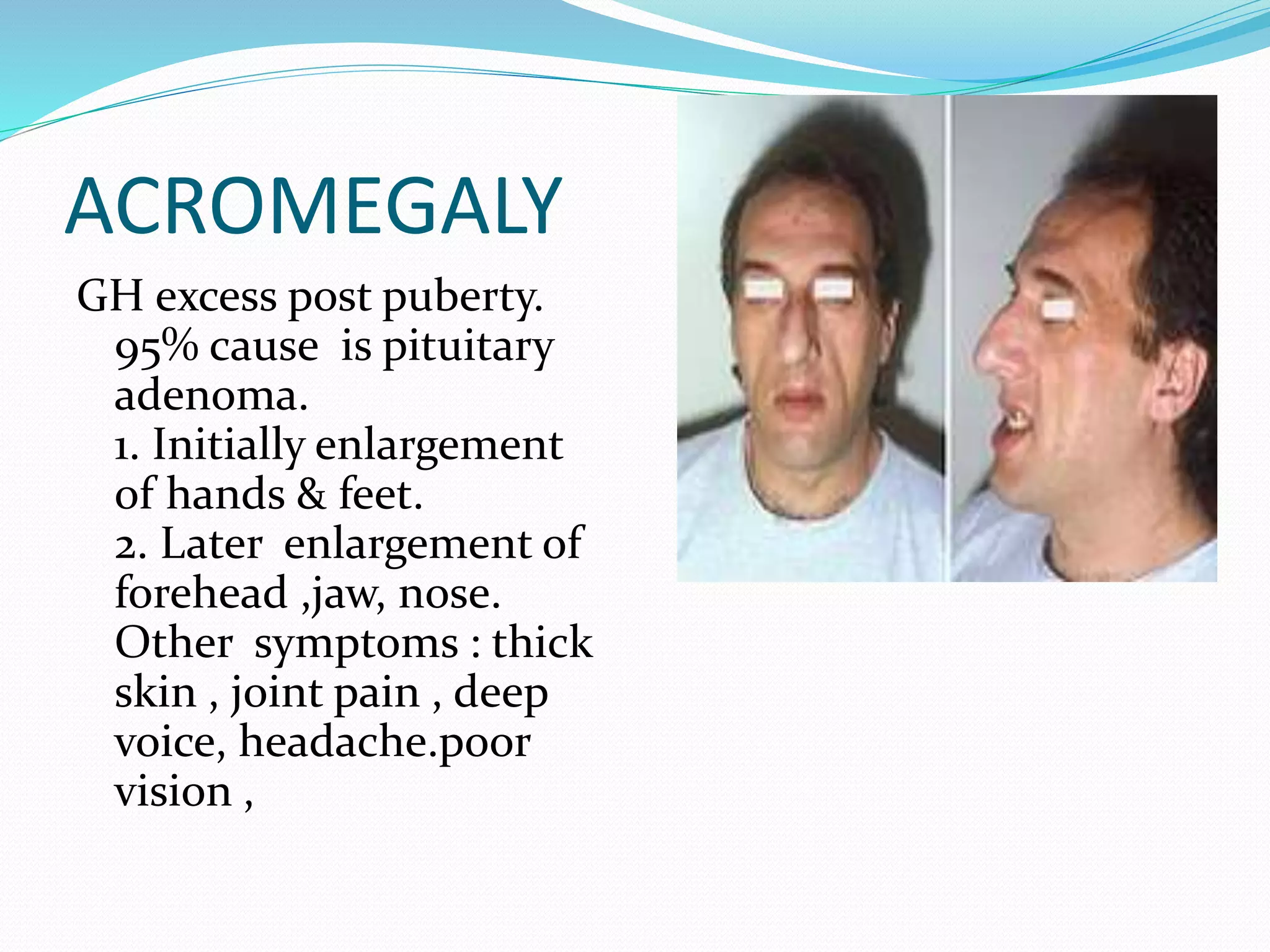 Growth hormone | PPTX