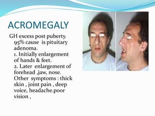 Growth hormone | PPTX