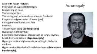 Growth Hormone | PPT
