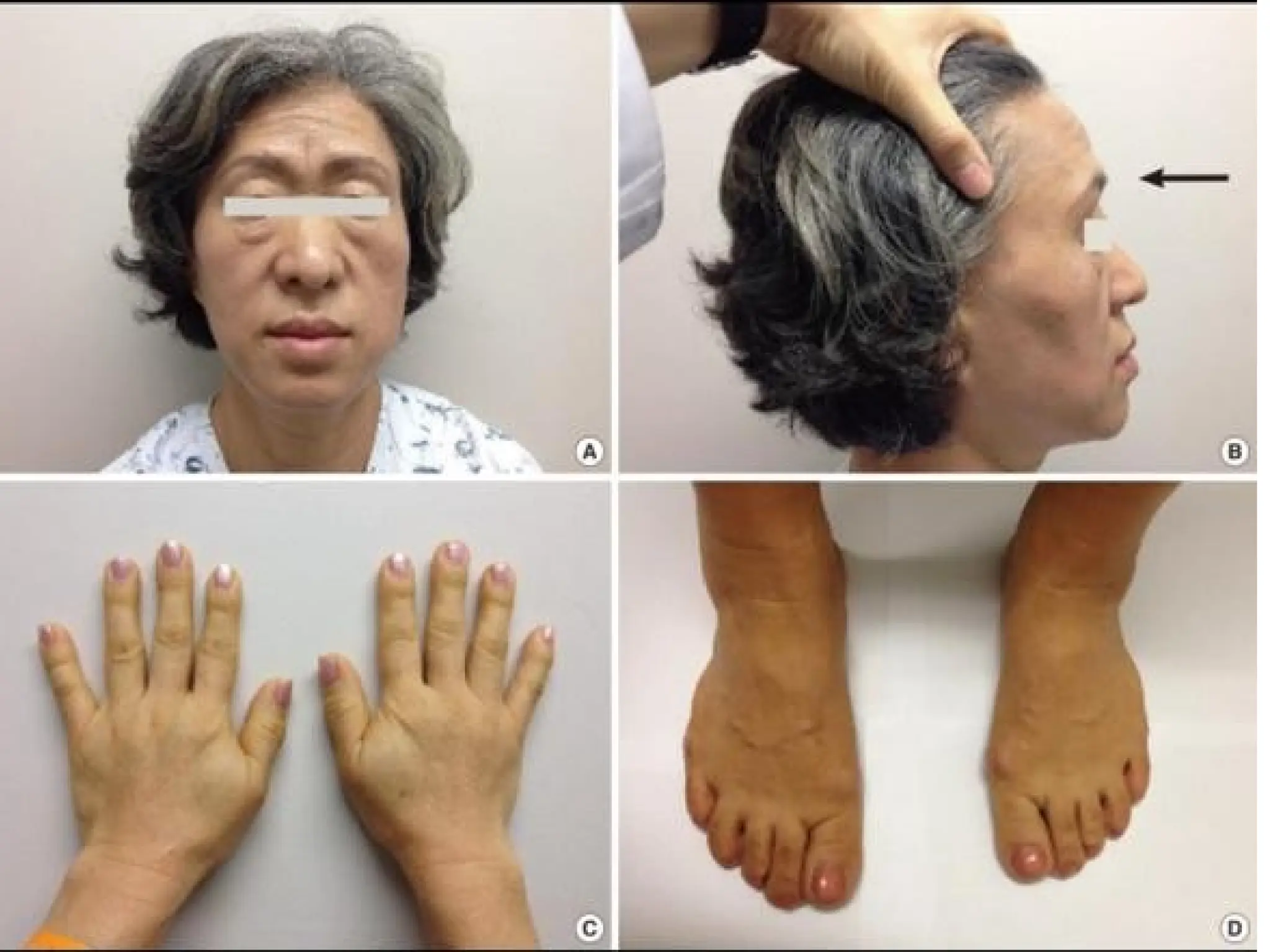 Growth hormone by Dr Kondam AmbareeshaGoud | PPTX