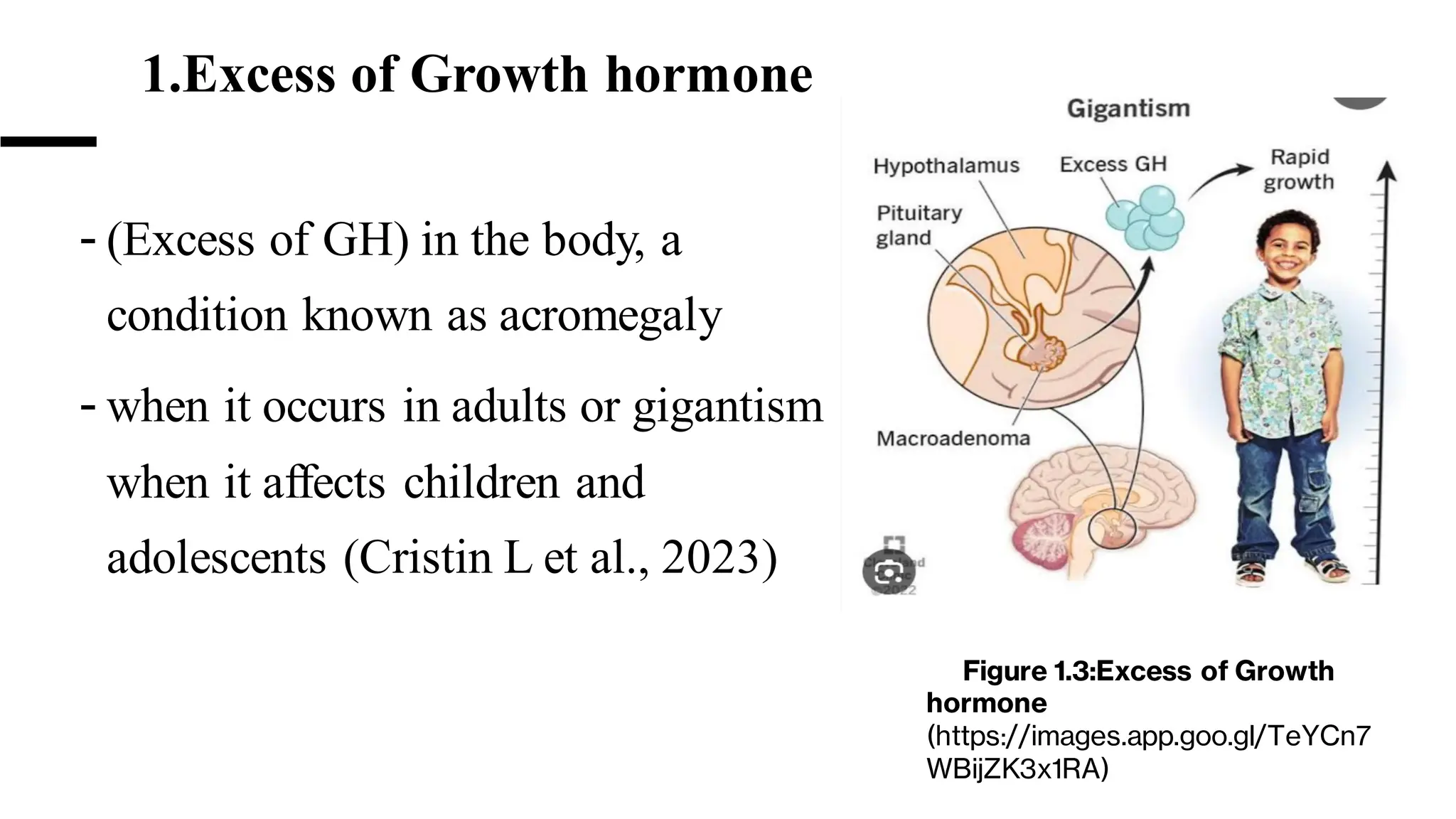 Growth hormone abnormalities upregulation and downregulation of growth ...