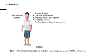 Growth hormone abnormalities upregulation and downregulation of growth ...