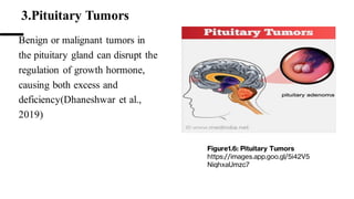 Growth hormone abnormalities upregulation and downregulation of growth ...
