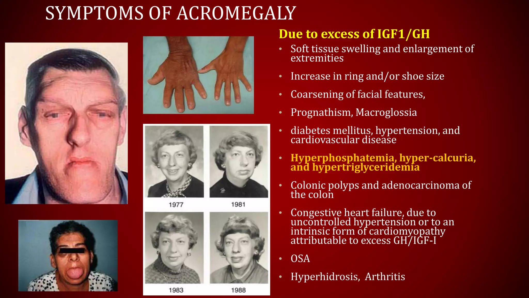 Growth hormone its deficiency and excess | PPTX