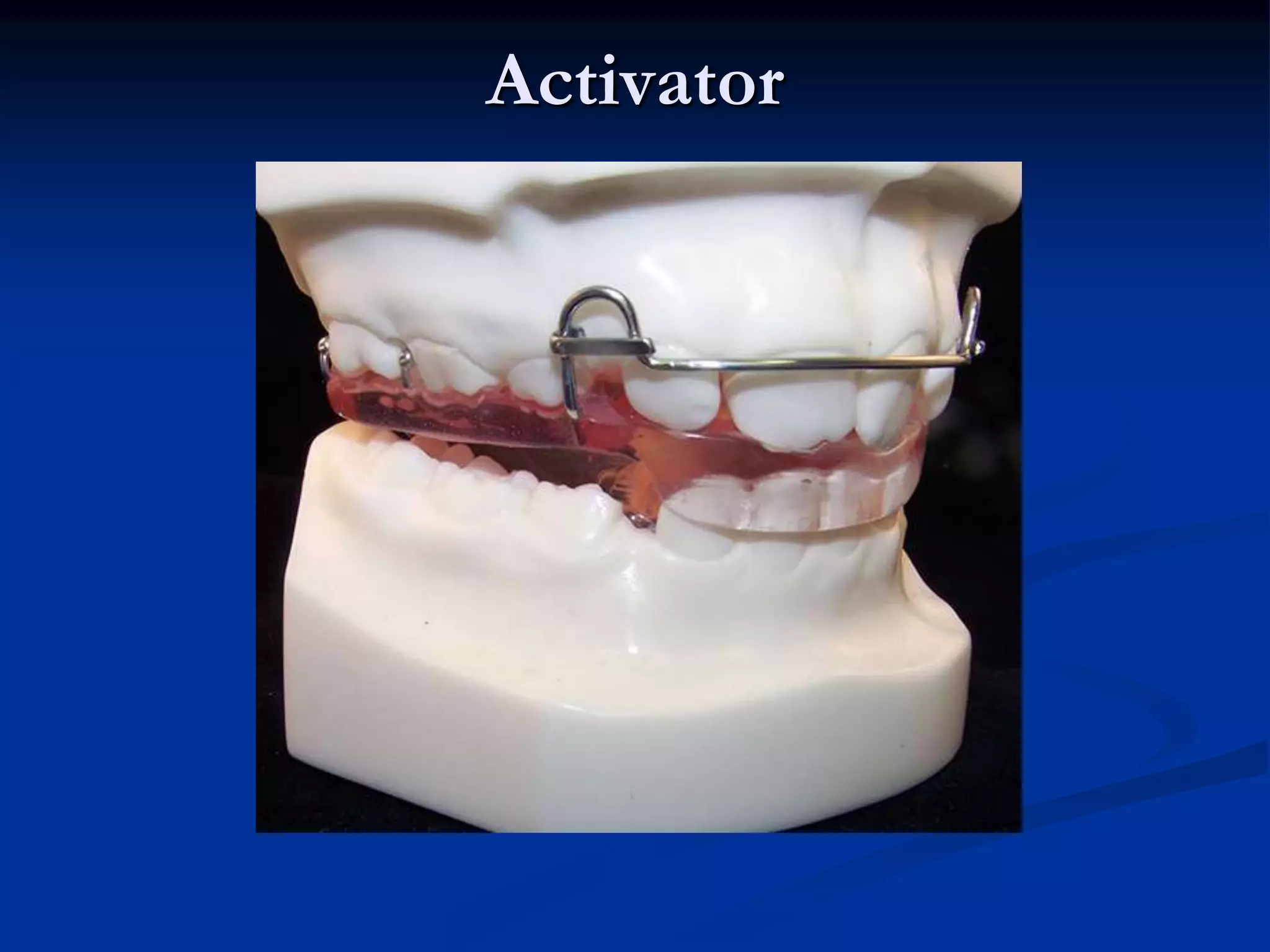 Growth modification of different types of malocclusion | PPTX