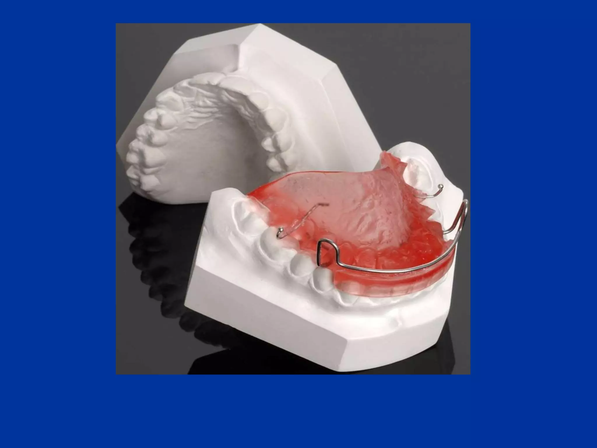 Growth modification of different types of malocclusion | PPTX