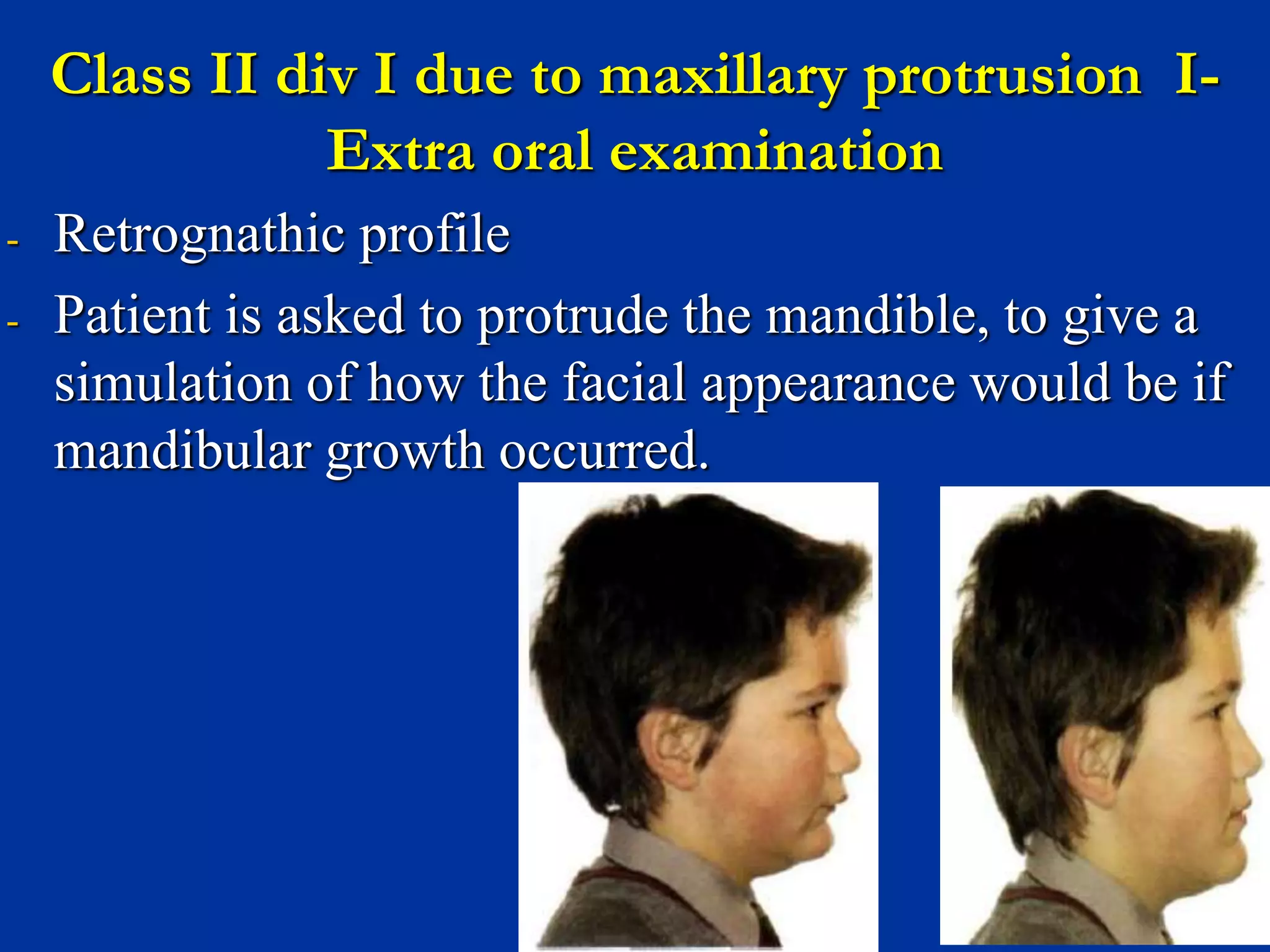 Growth modification of different types of malocclusion | PPTX