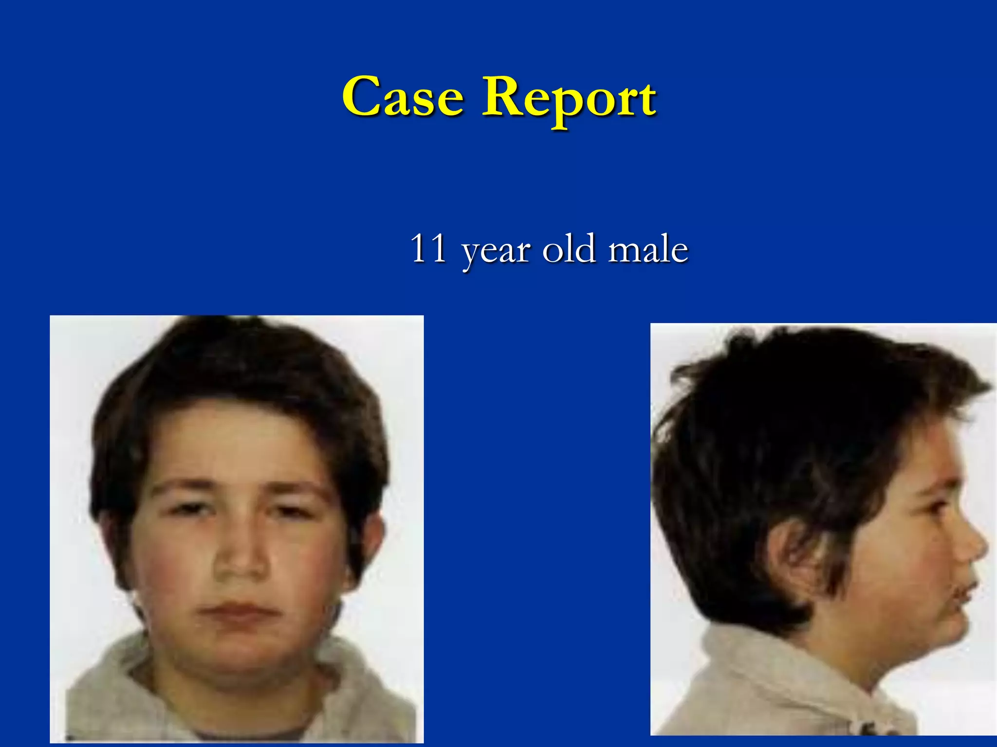Growth modification of different types of malocclusion | PPTX