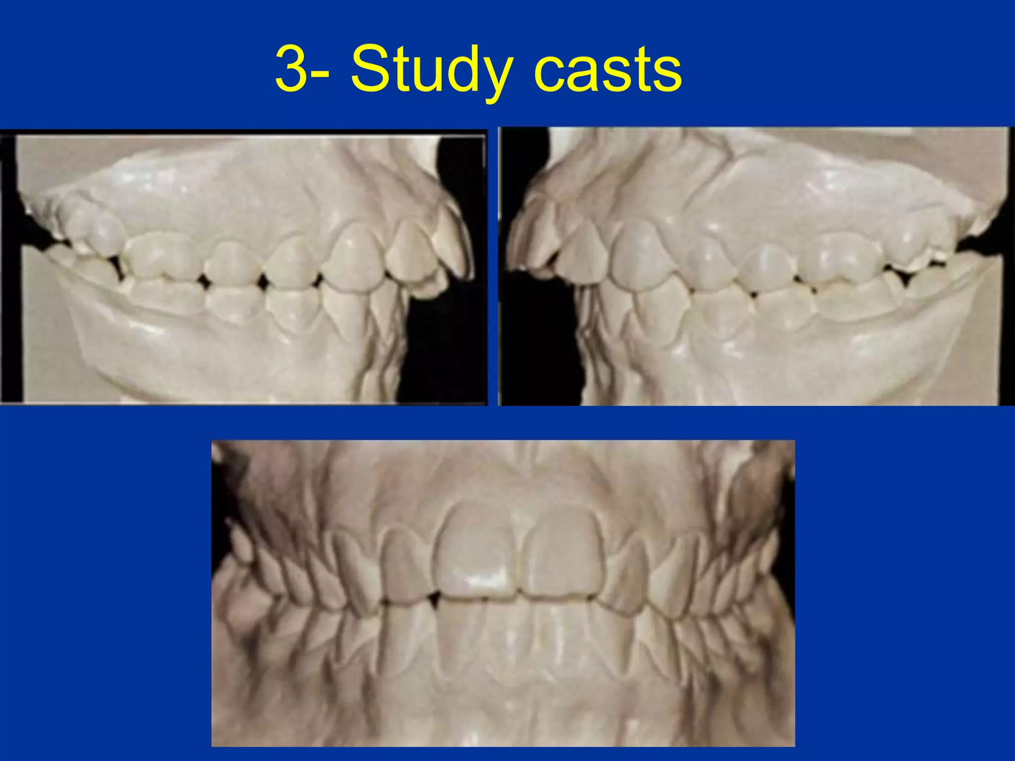 Growth modification of different types of malocclusion | PPTX
