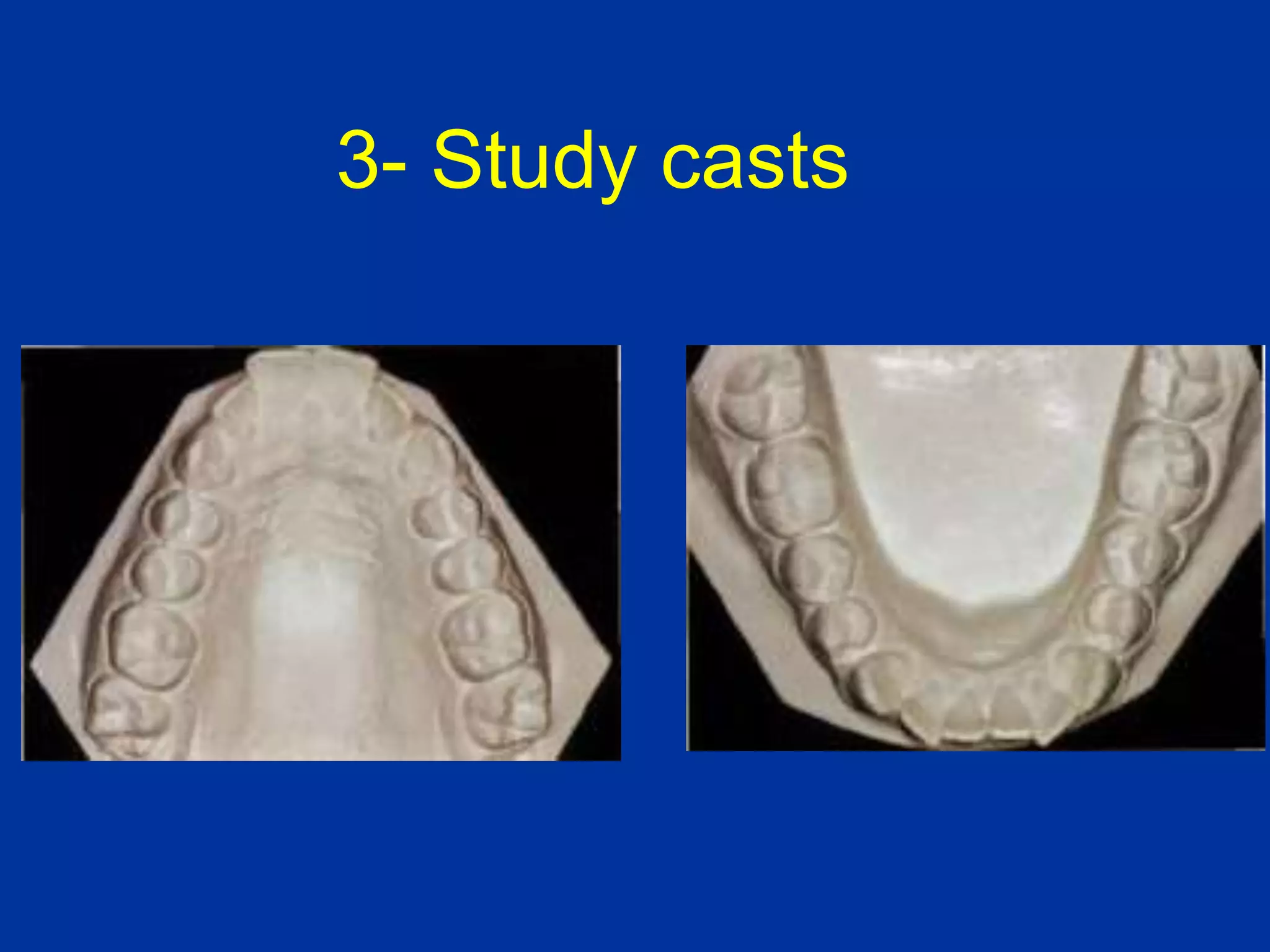 Growth modification of different types of malocclusion | PPTX
