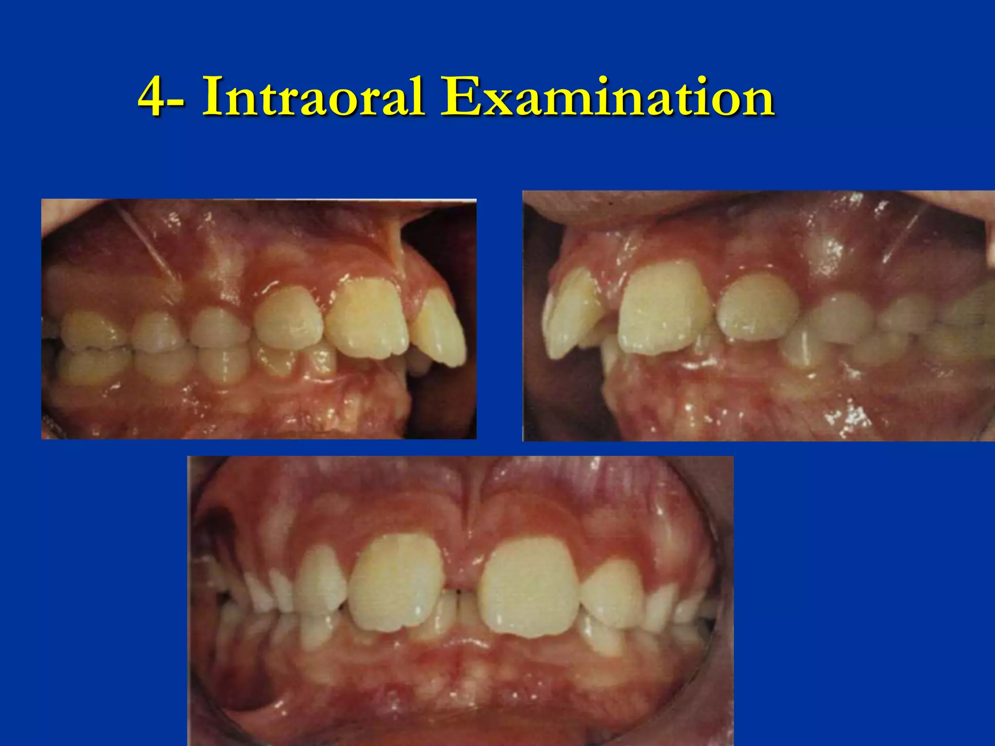 Growth modification of different types of malocclusion | PPTX