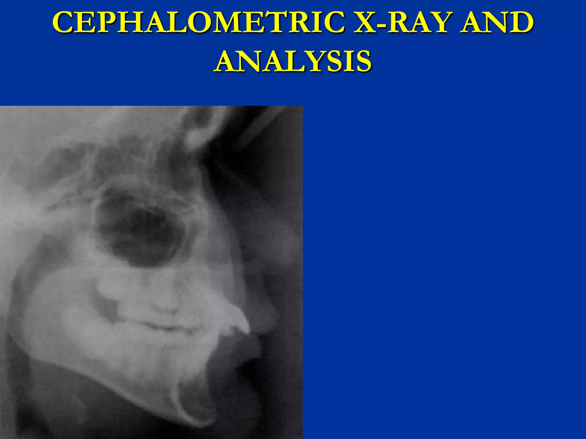 Growth modification of different types of malocclusion | PPTX