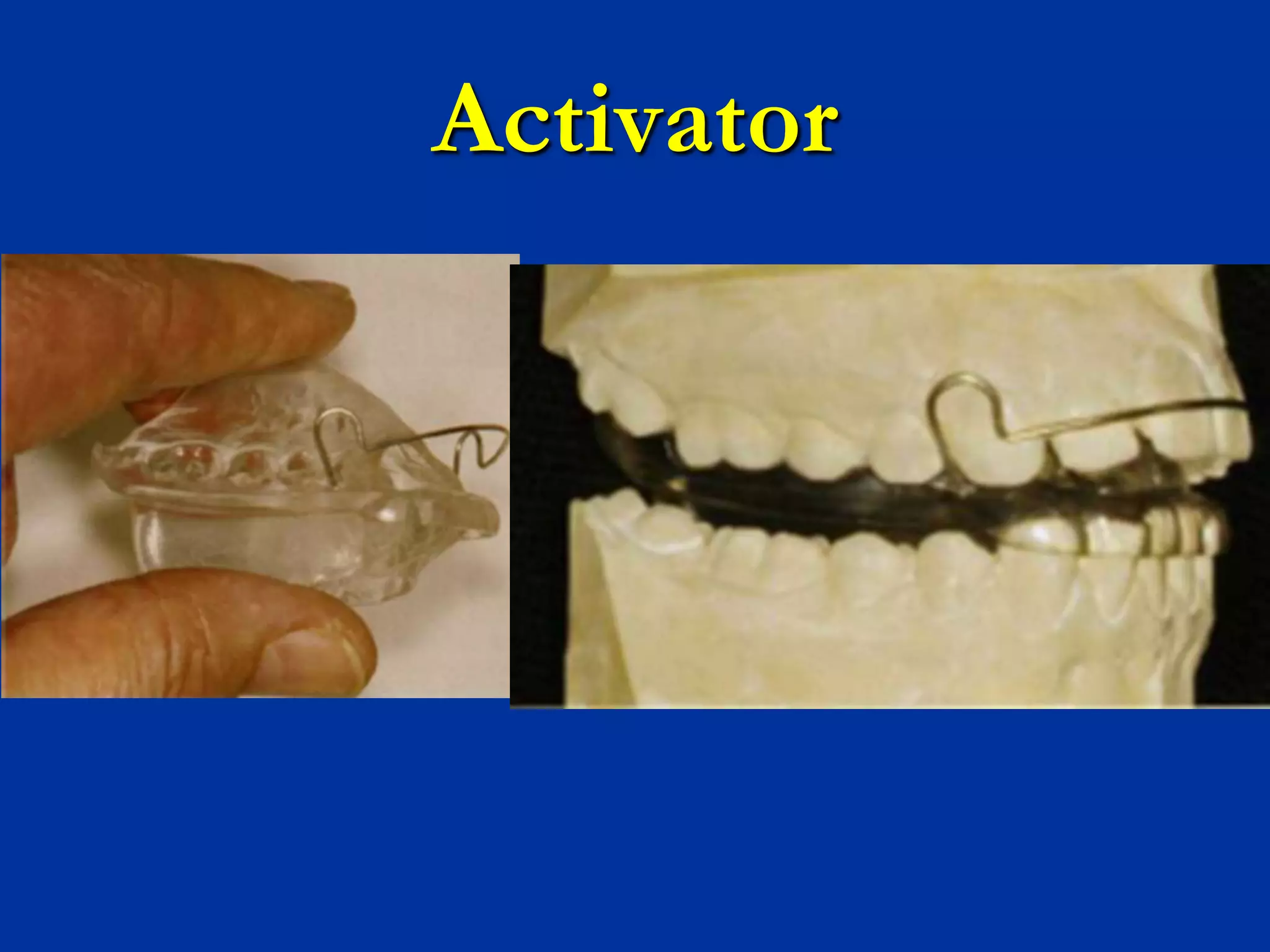 Growth modification of different types of malocclusion | PPTX