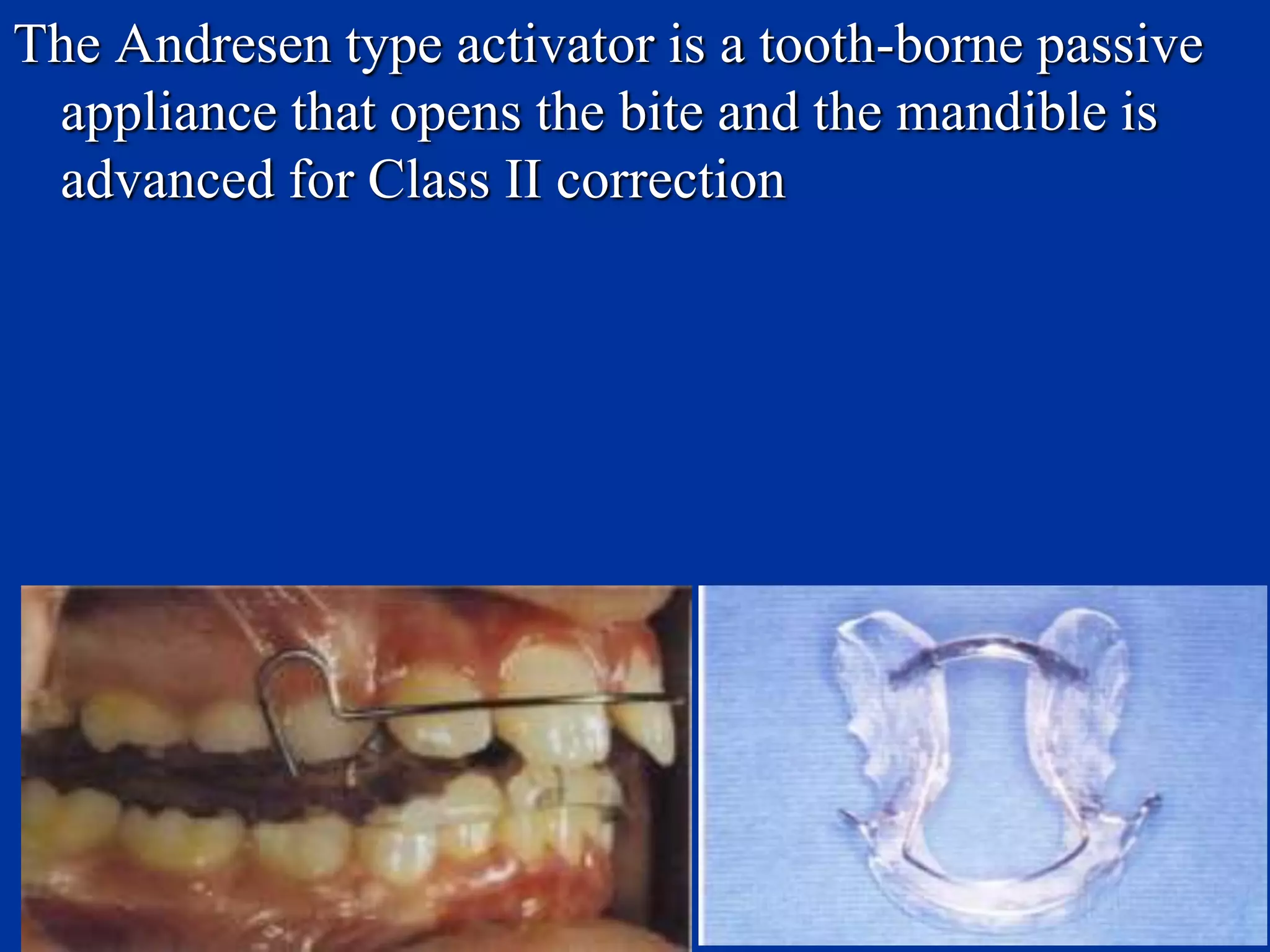 Growth modification of different types of malocclusion | PPTX