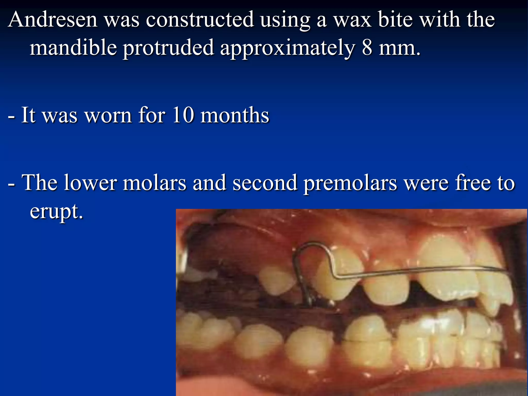 Growth modification of different types of malocclusion | PPTX