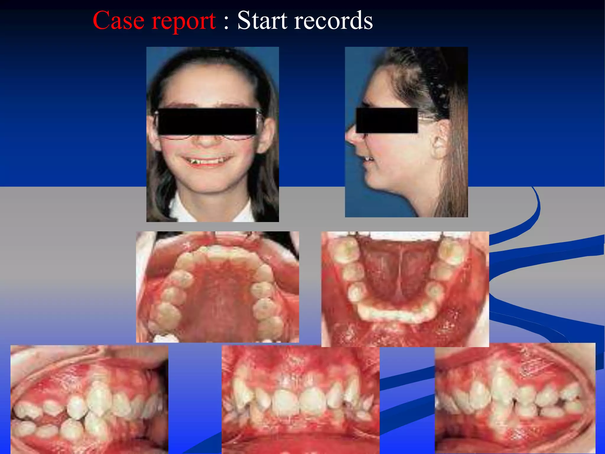 Growth modification of different types of malocclusion | PPTX