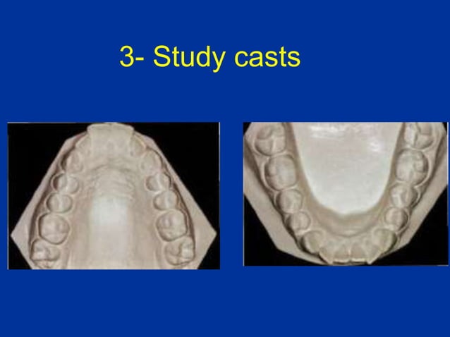 Growth modification of different types of malocclusion | PPTX